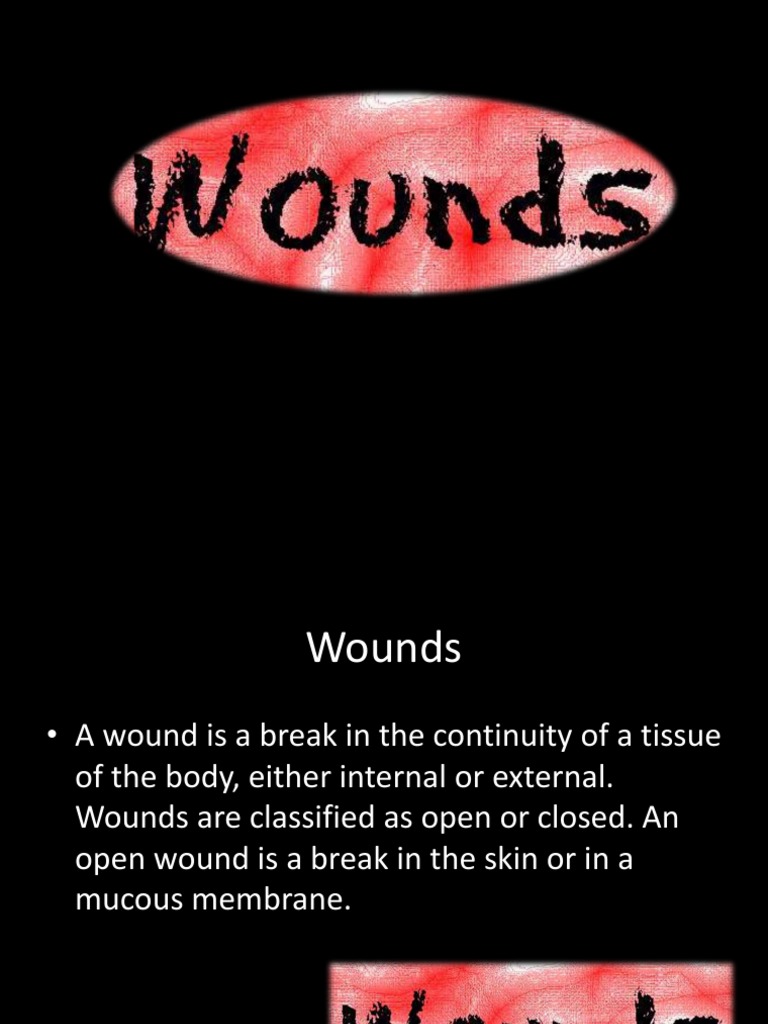 Classification and Types of Open and Closed Wounds: A Guide to Wound ...