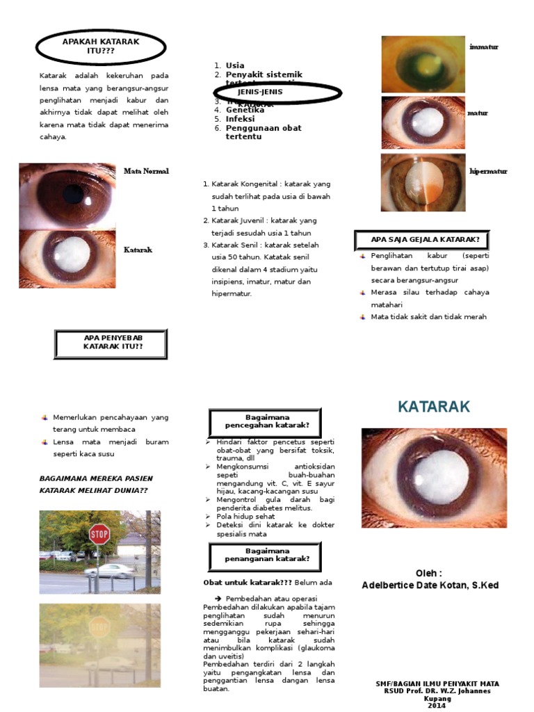 Leaflet Katarak | PDF