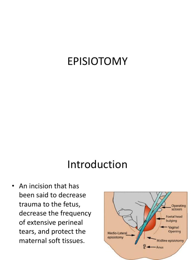 Episiotomy Teaching | PDF | Clinical Medicine | Medical Specialties