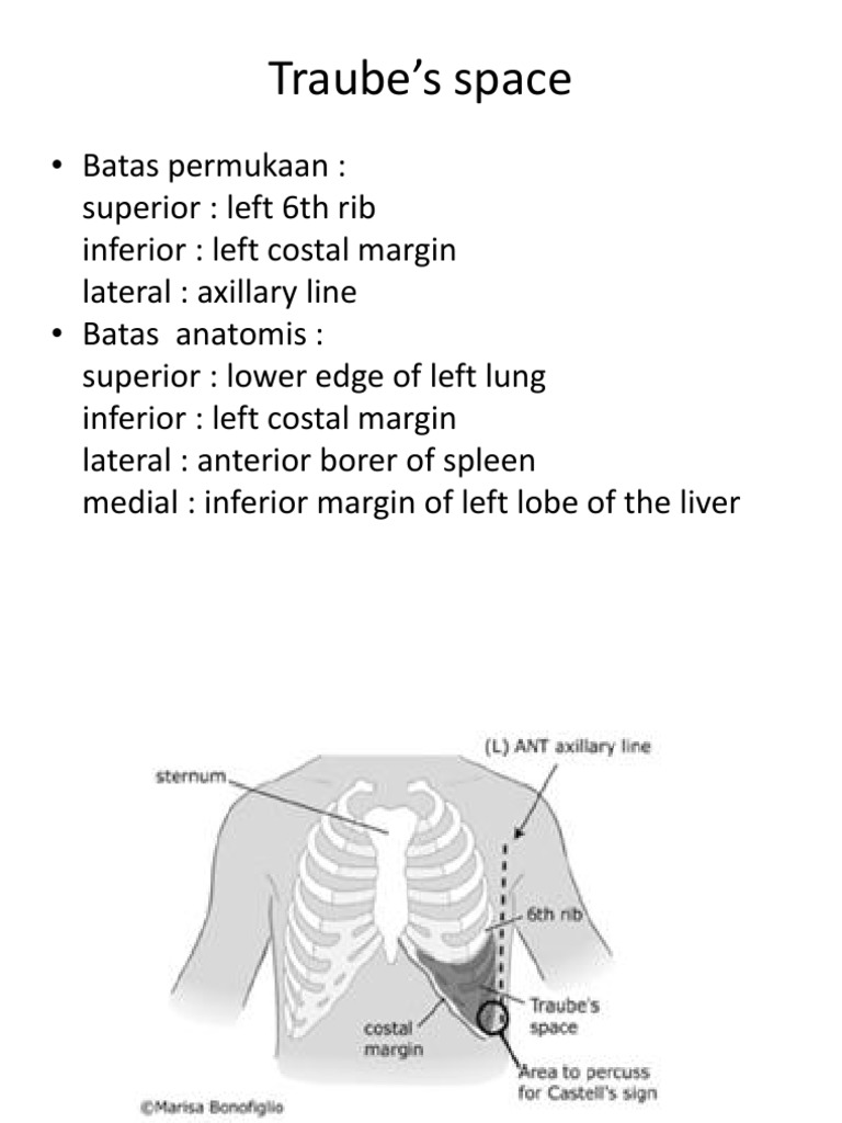 Traube's Space | PDF