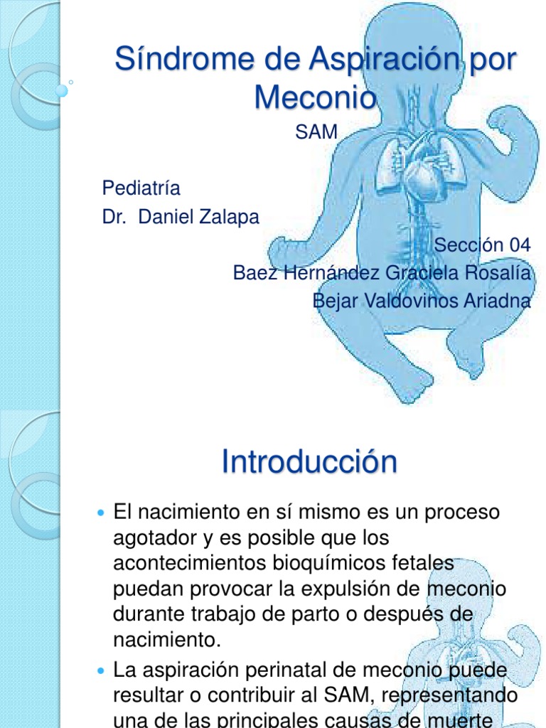 5. Síndrome Por Aspiración de Meconio SAM | Parto | Infantes