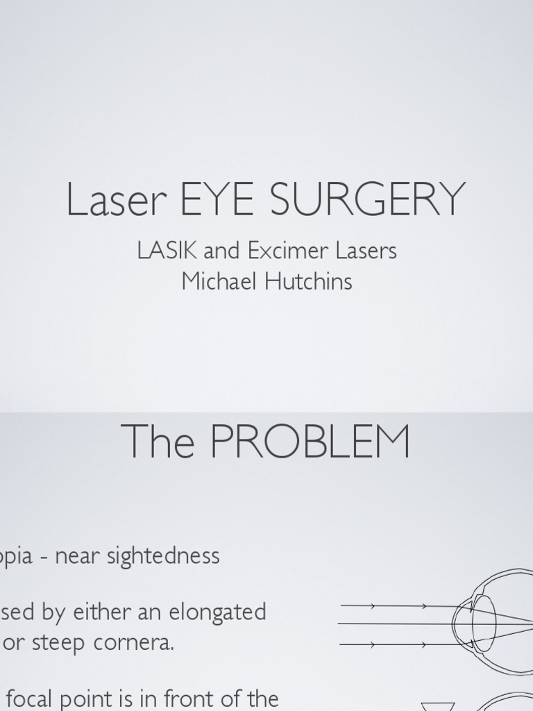 Laser Eye Surgery: LASIK and Excimer Lasers Michael Hutchins | PDF | Electromagnetic Radiation ...
