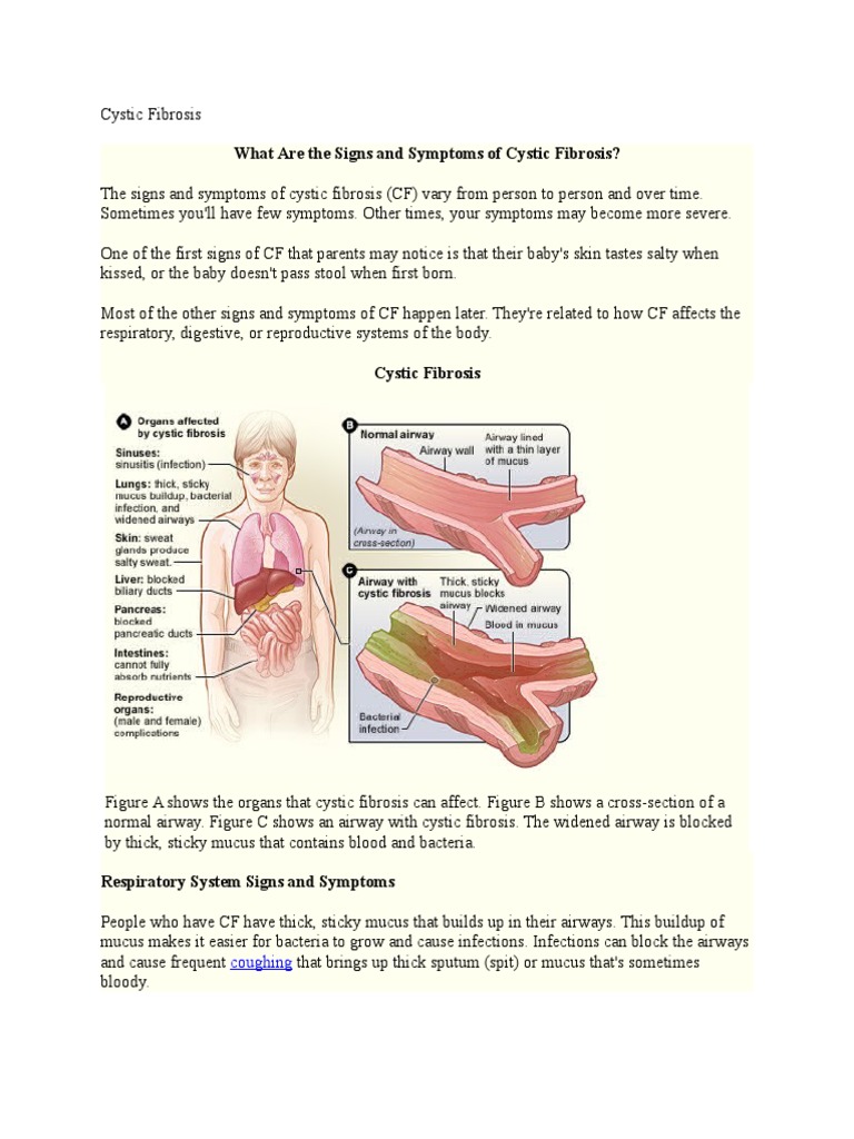 Signs and Symptoms of Cystic Fibrosis: A Comprehensive Overview of the ...