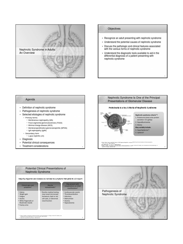 Nephrotic Syndrome Handout | Kidney Disease | Kidney