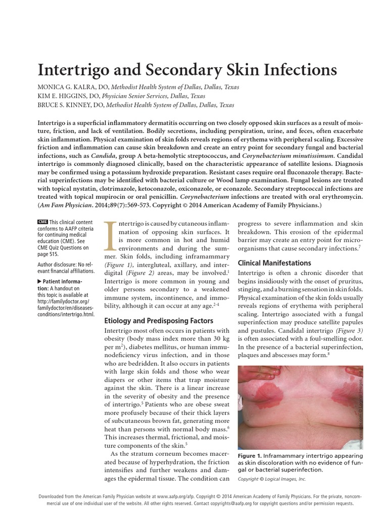 Intertrigo and Secondary Skin Infections | PDF | Candidiasis | Topical ...