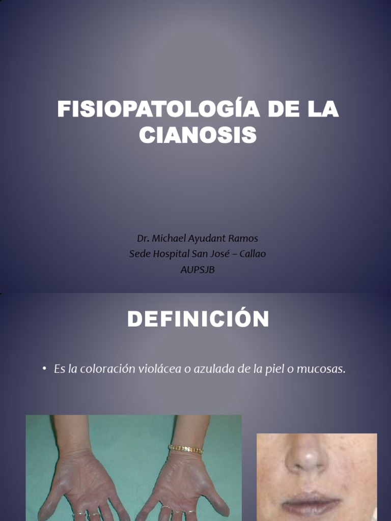 6-Fisiopatología de La Cianosis | PDF