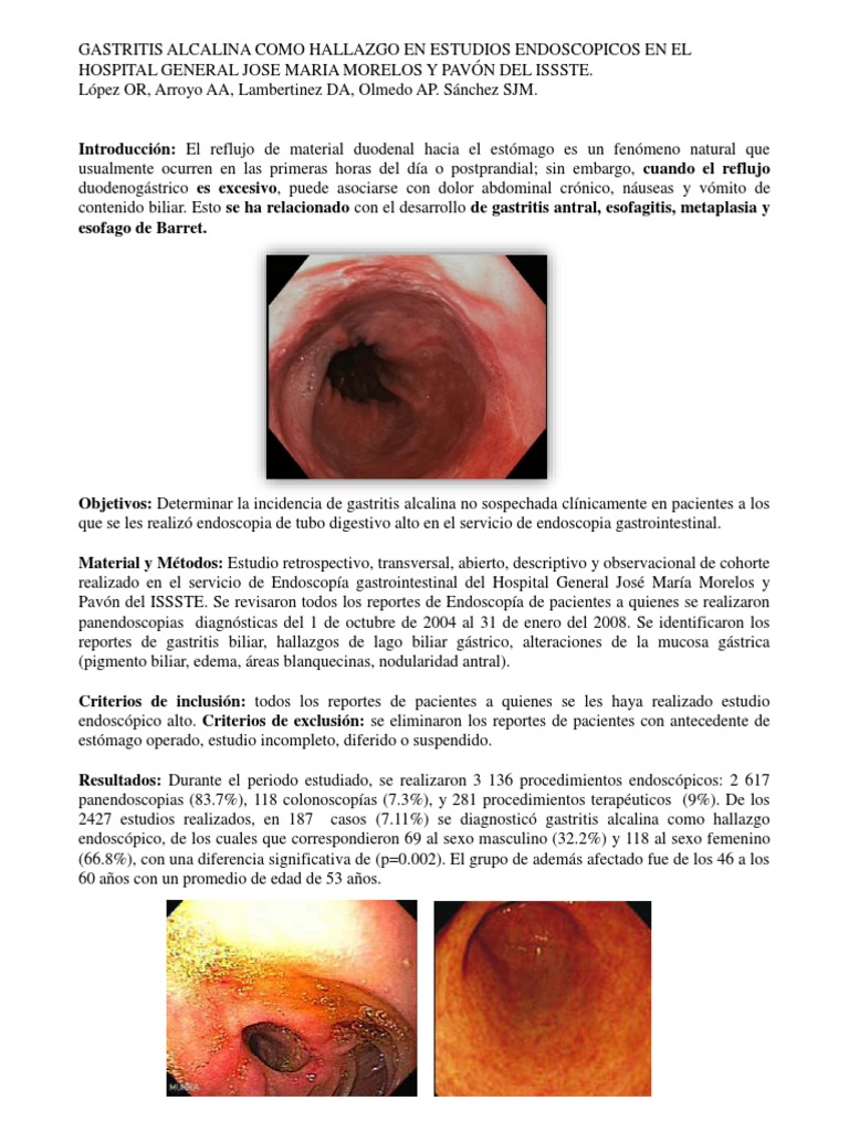 Gastritis Alcalina Estudios Endoscopicos | PDF | Endoscopia | Estómago