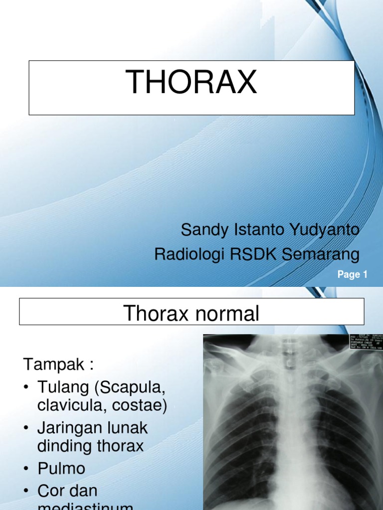Proyeksi dan Interpretasi Thorax | PDF