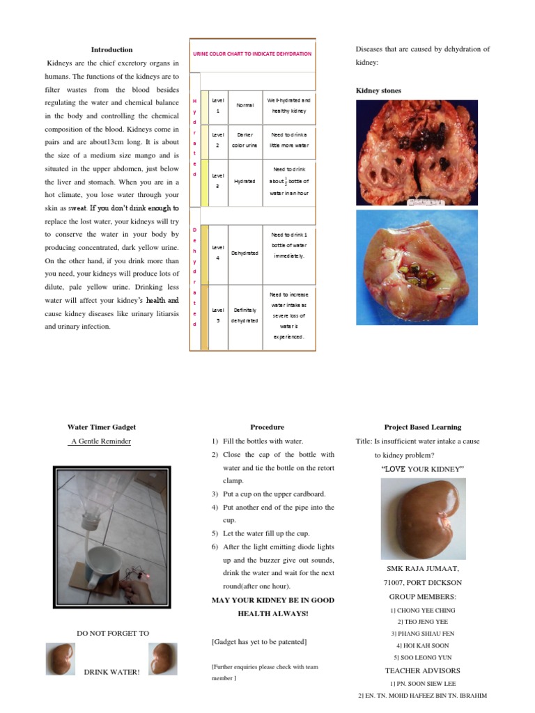 Urine Color Chart To Indicate Dehydration | Download Free PDF | Kidney ...