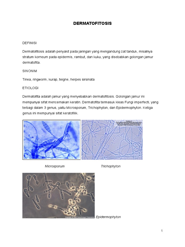 Klasifikasi dan Gejala Dermatofitosis | PDF | Sains & Matematika