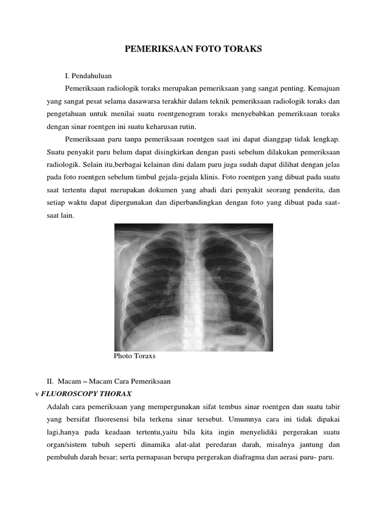 Pemeriksaan Foto Toraks: Metode & Indikasi | PDF | Sains & Matematika ...