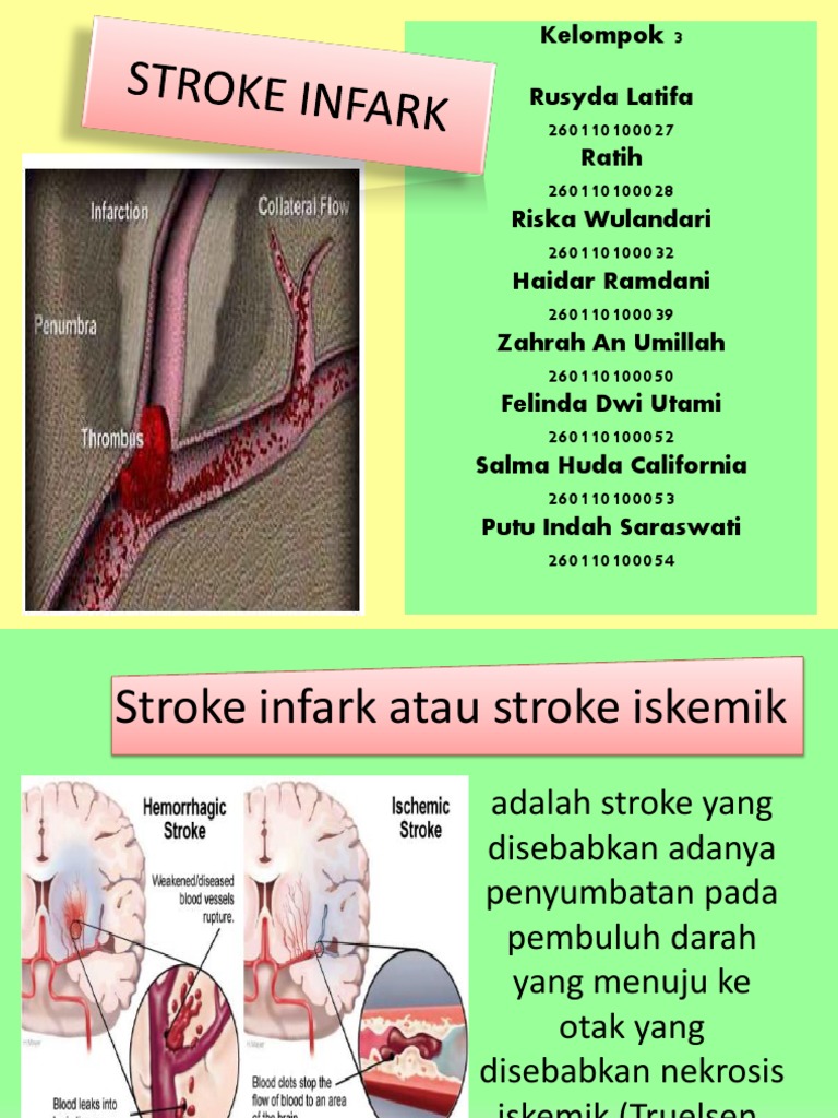 Patofisiologi Stroke Infark | PDF