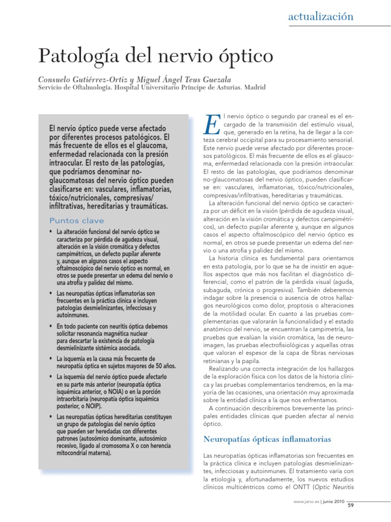 Nervio Optico | PDF
