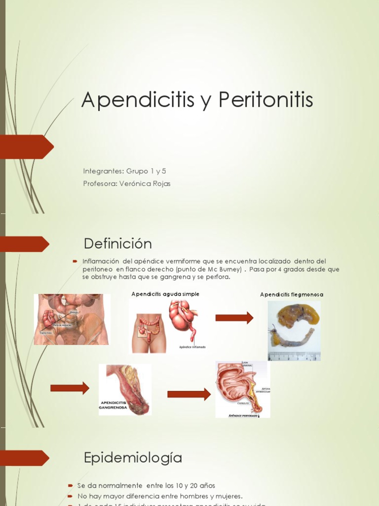 Apendicitis y Peritonitis | Medicina CLINICA | Enfermedades y trastornos