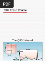 ICU One Pager External Pacemakers v11 | PDF | Artificial Cardiac ...
