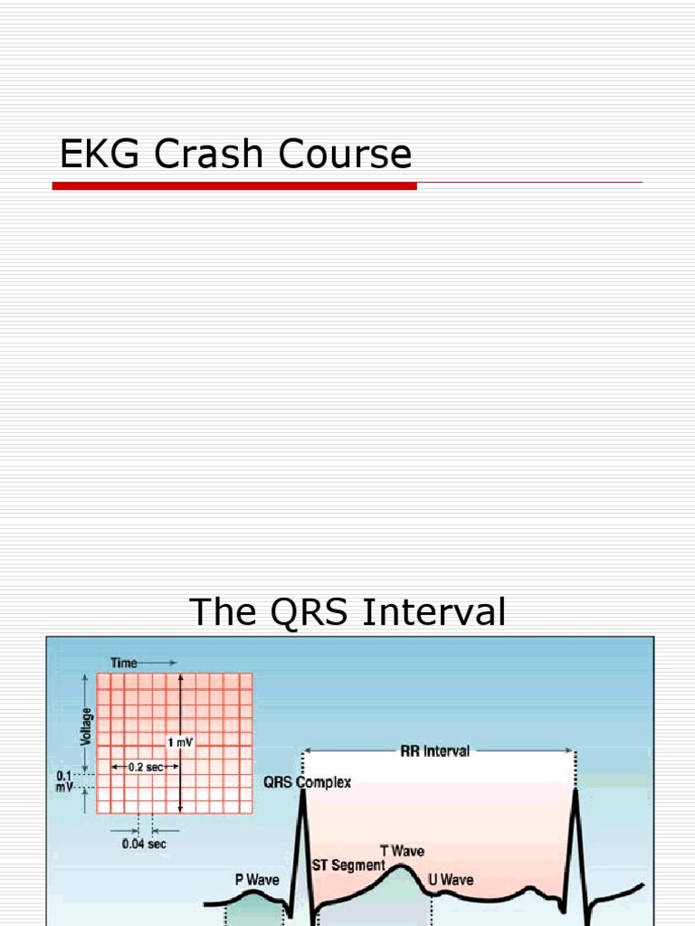 EKG Crash Course NuRsing 390 SMC - 4 | PDF | Electrocardiography ...