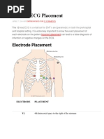 15 Lead ECG Placement Guide | PDF