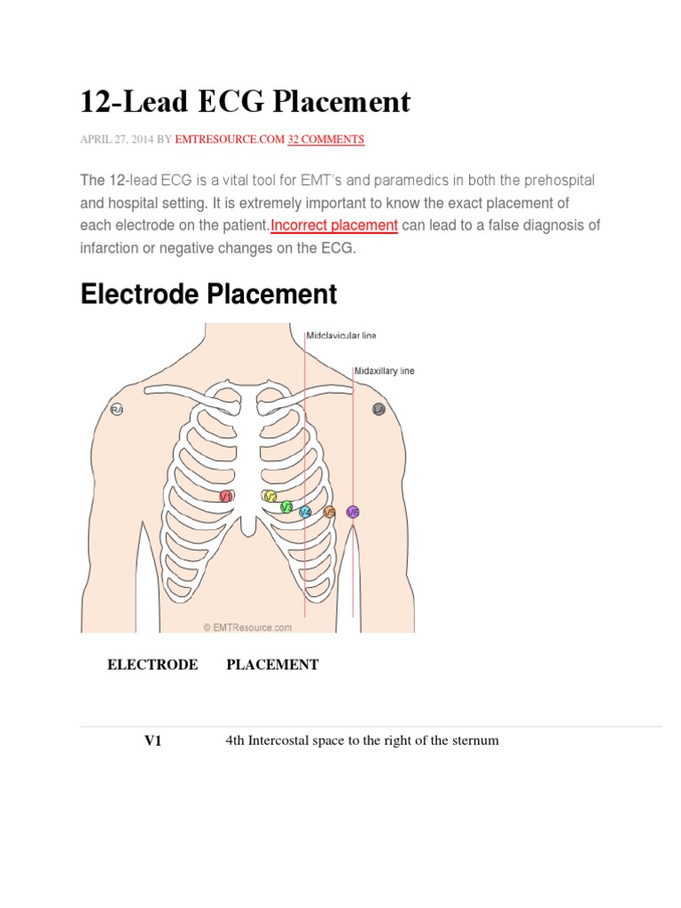 Ecg Placement | PDF | Electrocardiography | Visual Cortex