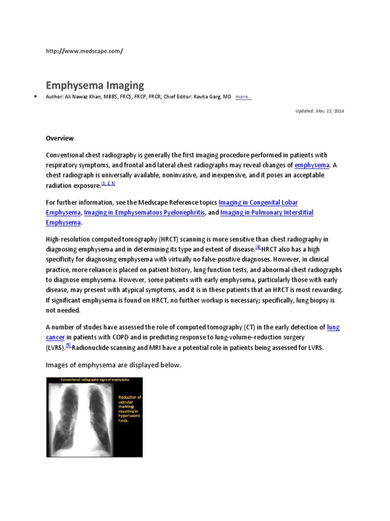 Diagnosing and Imaging Emphysema: The Role of Chest Radiography and ...