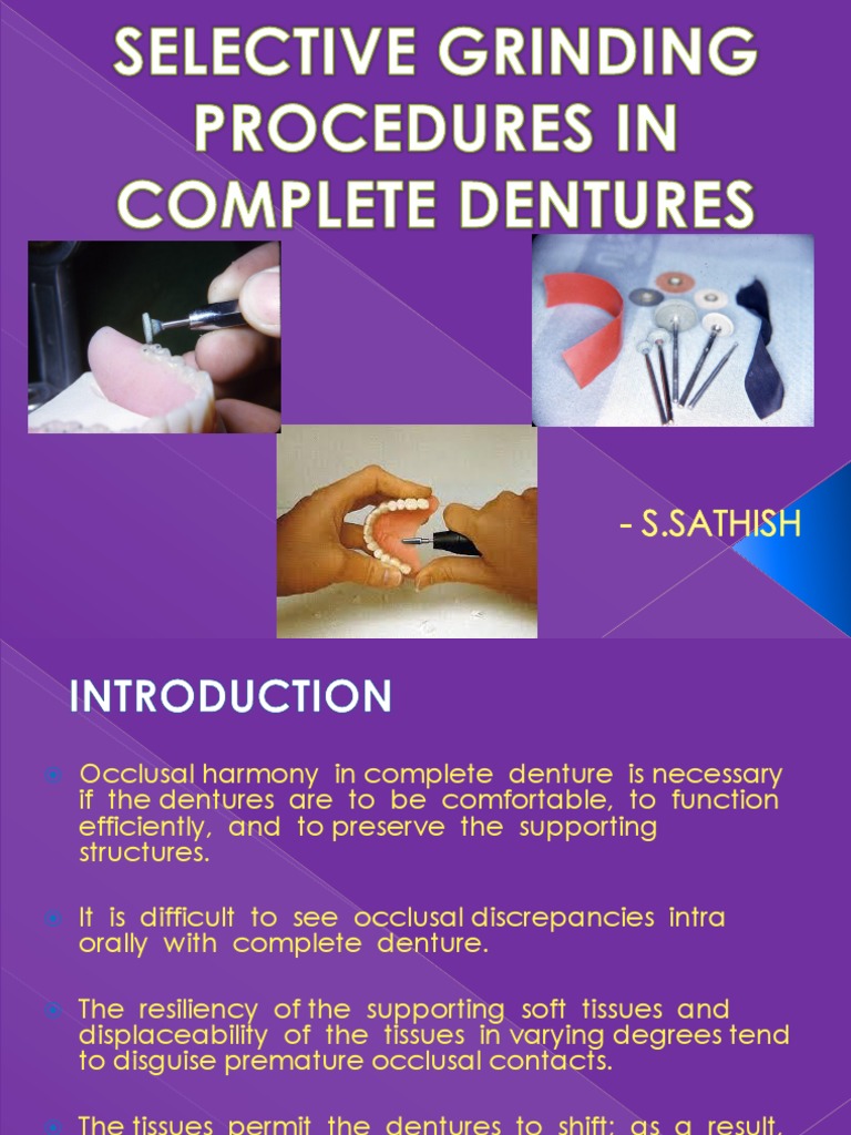 Selective Grinding -Sathish | Dentures | Tooth