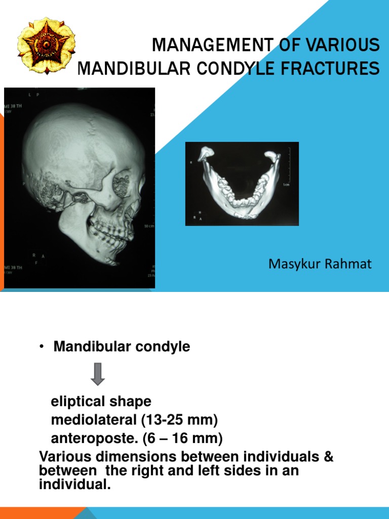 Management of Various Mandibular Condyle Fractures 1 | PDF