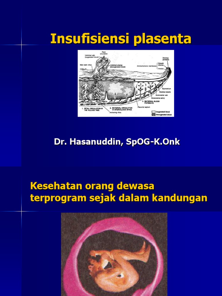Insufisiensi Plasenta | PDF