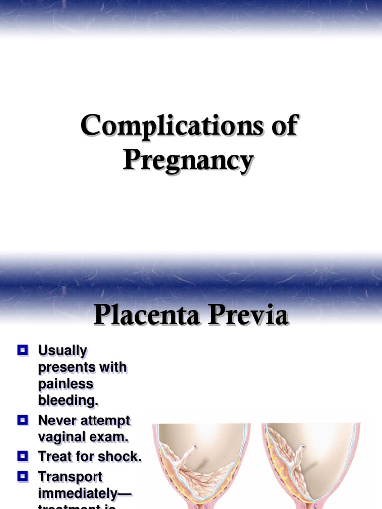 A Comprehensive Guide to the Management of Complications During ...