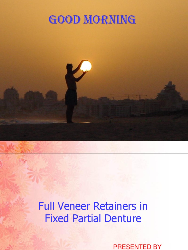 Full Veneer Retainers in FPD | PDF | Dentistry | Mouth