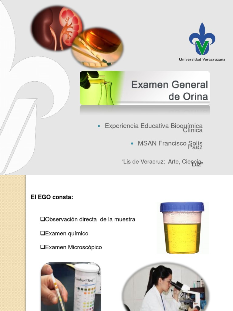 Análisis del contenido y proceso del examen general de orina (EGO) a ...
