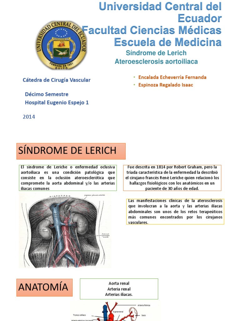 Síndrome de Lerich Terminado | PDF | Angiografía | Trombo