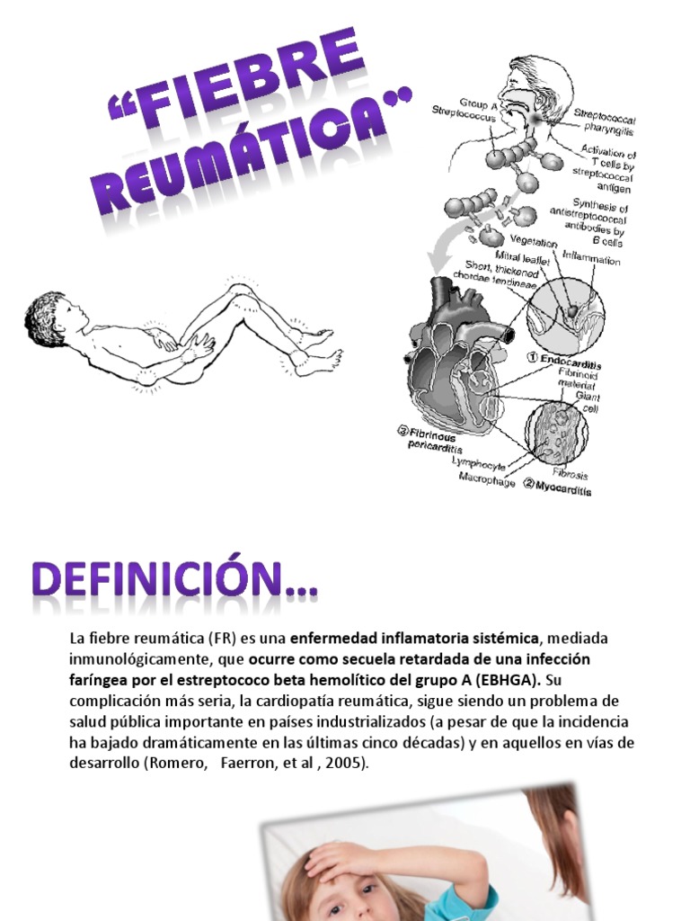 Fiebre Reumatica | PDF | Rtt | Inmunología