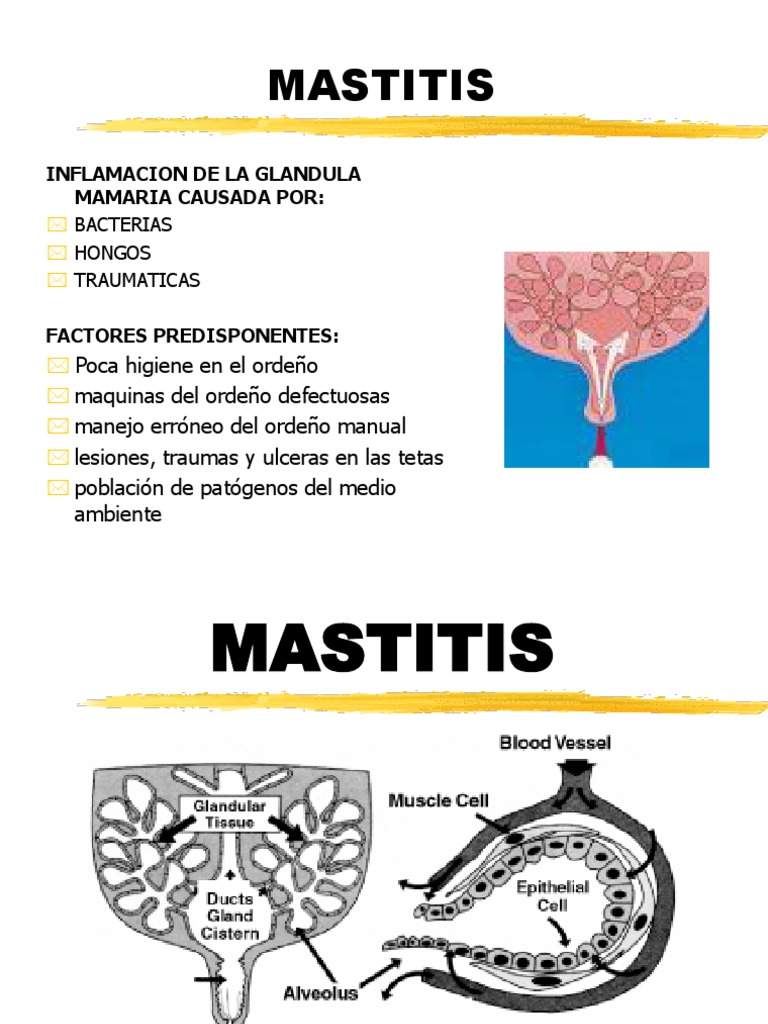 Mastitis: Inflamacion De La Glandula Mamaria Causada Por