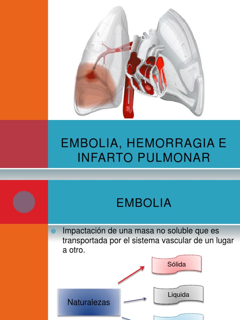 Embolia Hemorragia e Infarto Pulmonar | Descargar gratis PDF | Embolia ...