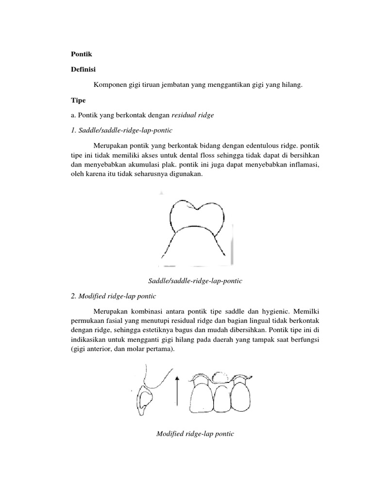 Jenis-Jenis Pontik Gigi dan Fungsinya | PDF