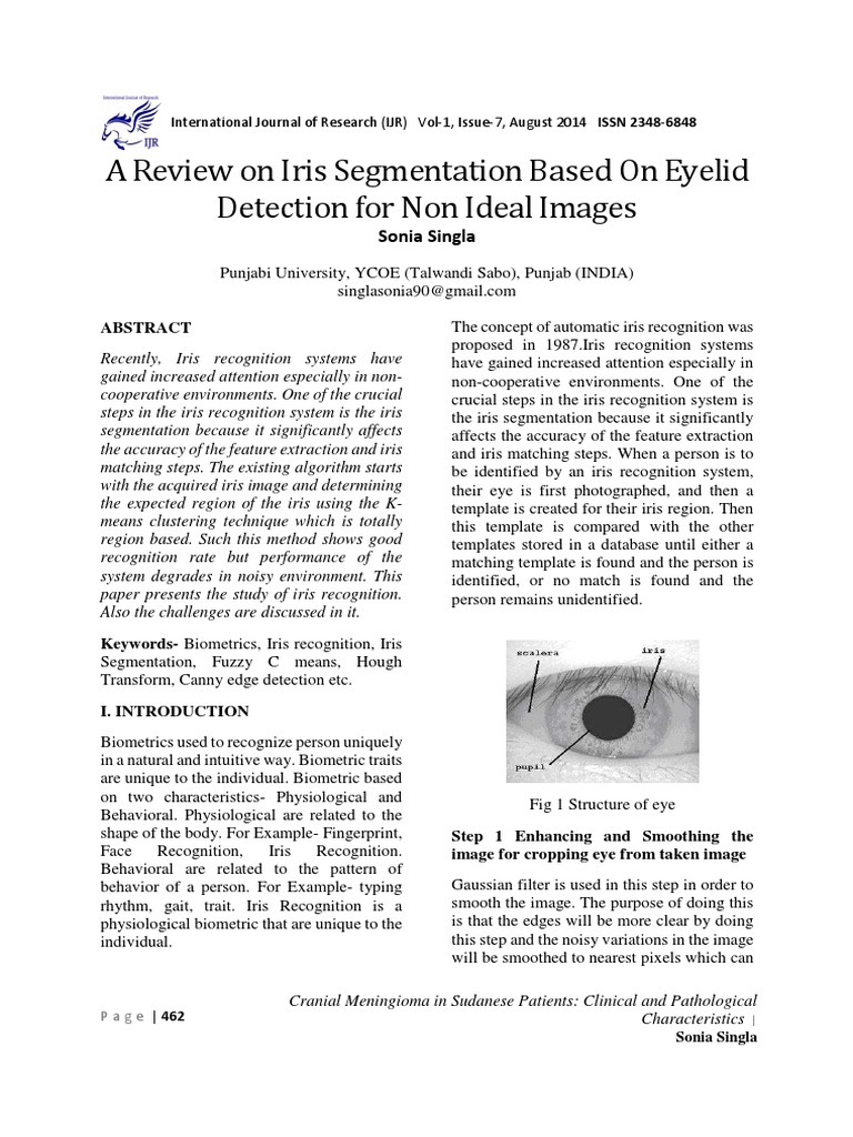 A Review On Iris Segmentation Based On Eyelid Detection For Non Ideal Images by Sonia Sigla ...