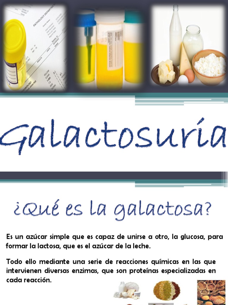 Galactosuria | PDF | Especialidades Medicas | Enfermedades y trastornos