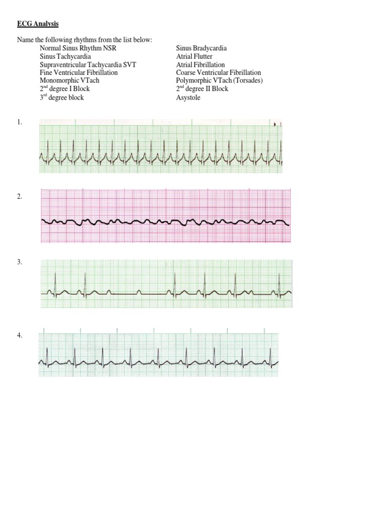 Acls | Cardiopulmonary Resuscitation | Cardiac Arrest