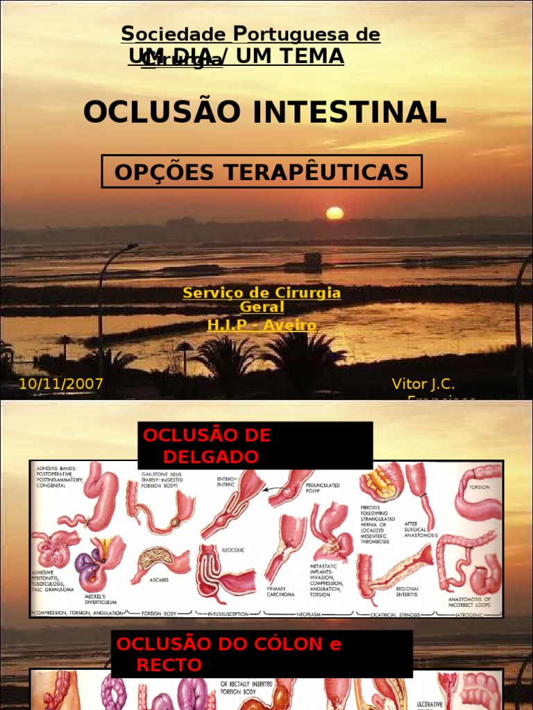 Oclusão Intestinal | PDF | Biologia | Ciências da Saúde
