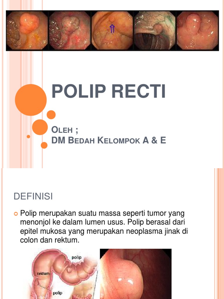 Polip Recti | PDF