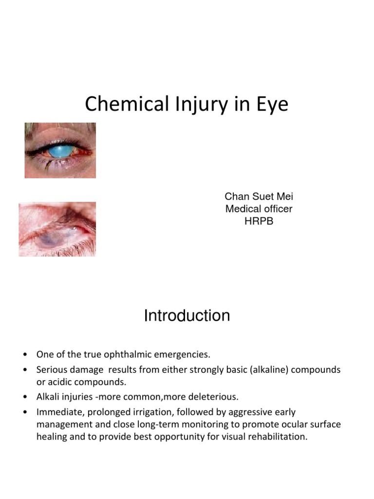 Ocular Chemical Injury Management Guide | PDF | Cornea | Healing