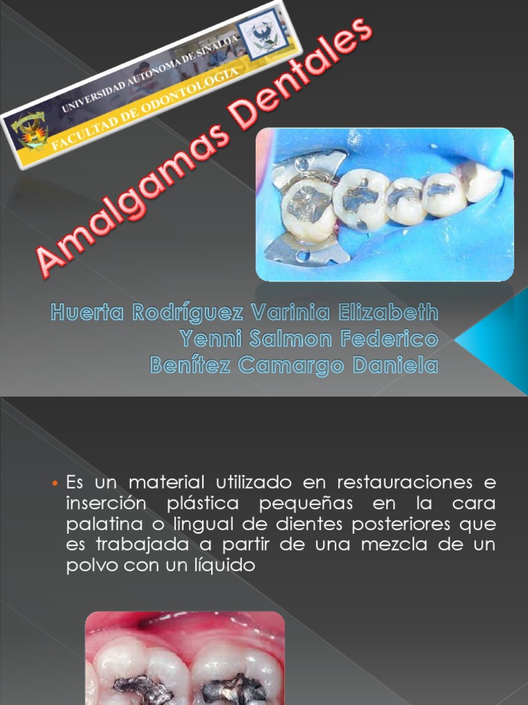 Amalgamas Dentales | Cobre | Mercurio (Elemento)