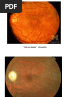 Tangent Screen Visual Field Testing | PDF | Retina | Color