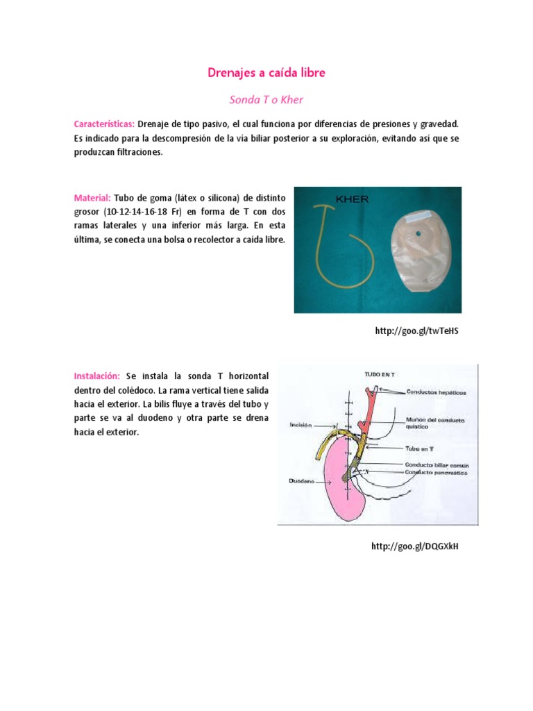Drenajes A Caída Libre Sonda T | PDF | Cirugía | Especialidades Medicas