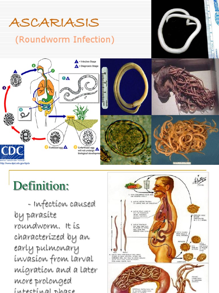 Ascariasis | Organ (Anatomy) | Health Sciences | Free 30-day Trial | Scribd
