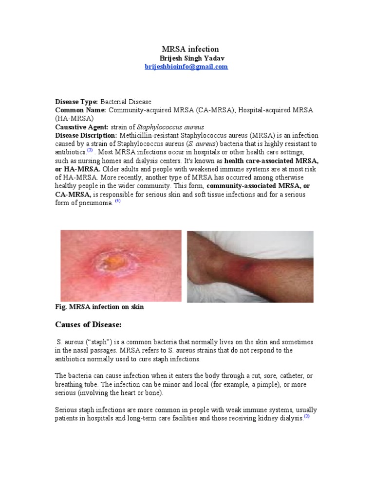 Bacterial Infection(MRSA Infection) | Methicillin Resistant ...