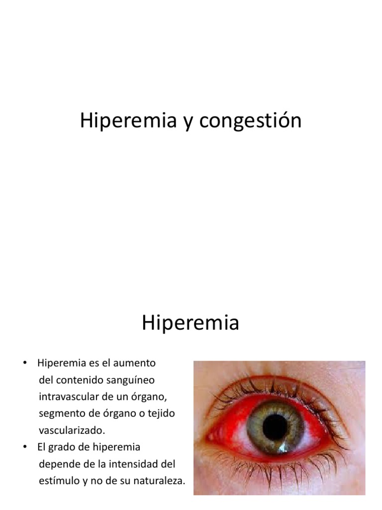 Hiperemia y Congestión | Coagulación | Edema