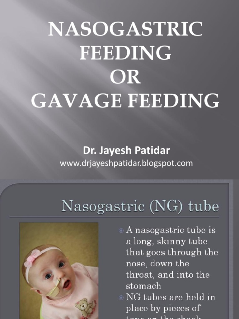 Nasogastric Feeding or Gavage Feeding | PDF | Clinical Medicine | Medicine