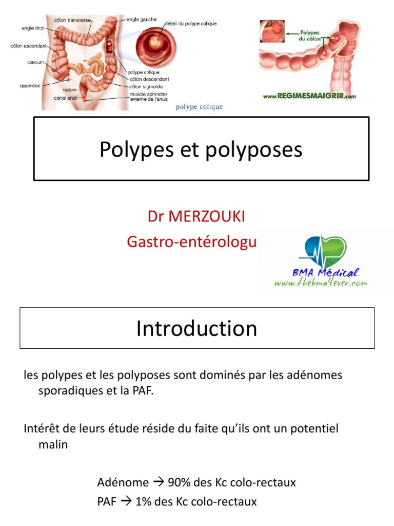 Polypes Et Polyposes | PDF | Coloscopie | Cancer