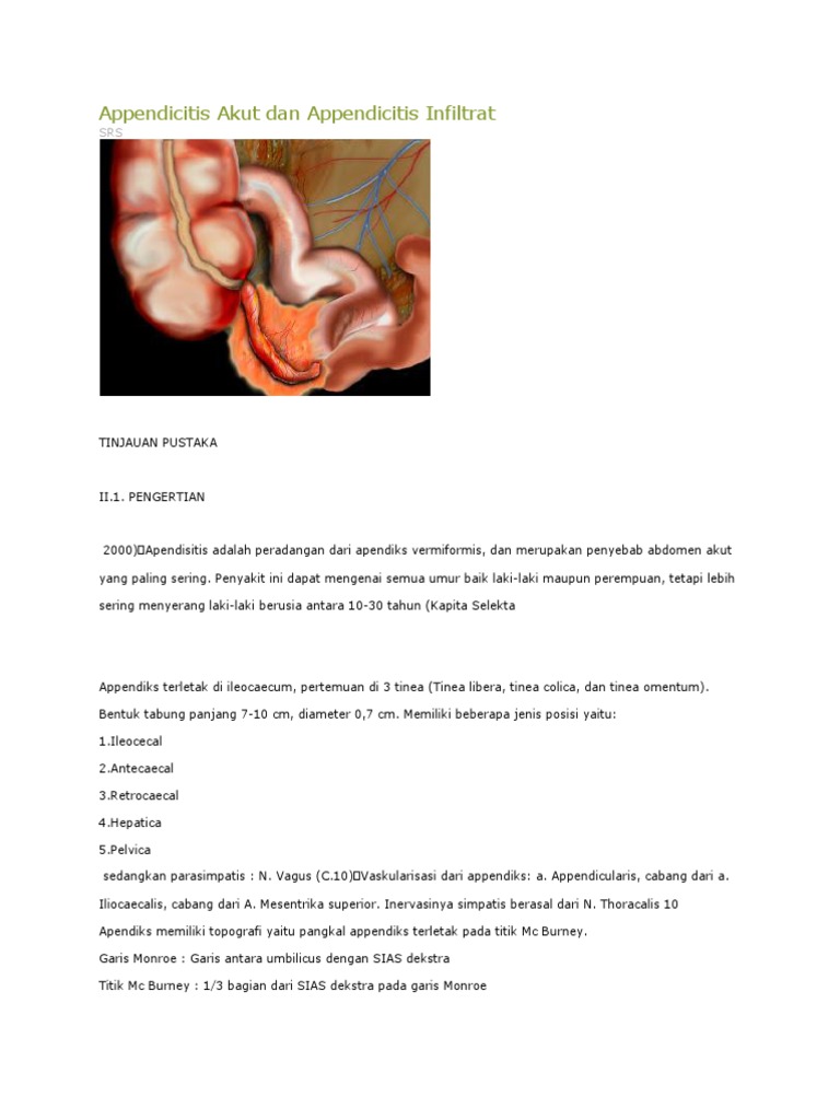 Appendicitis Akut Dan Appendicitis Infiltrat | PDF