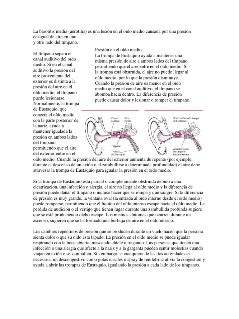La Barotitis Media | PDF